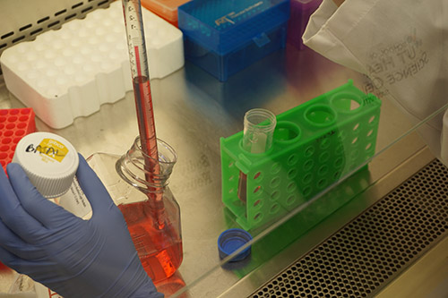 Lab work - Neurosurgery