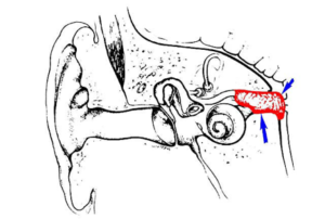 Acoustic Neuromas: What You Should Know - Neurosurgery